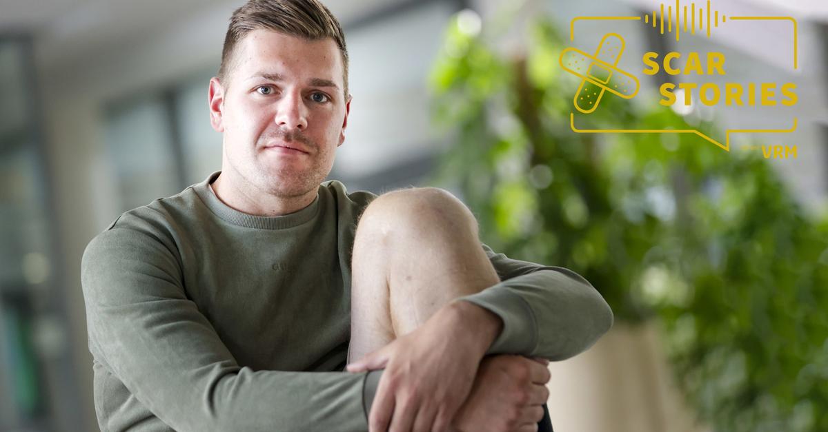 Scar Stories #2: Alex - Meine Narben vom Autounfall